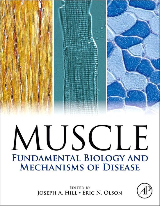 Muscle | 9780123815101 | Joseph Hill | Boeken | bol
