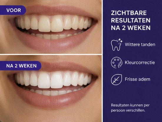 OptiSmile Teeth Whitening Strips 28 Stuks Tand Whitening Strips Mint ...