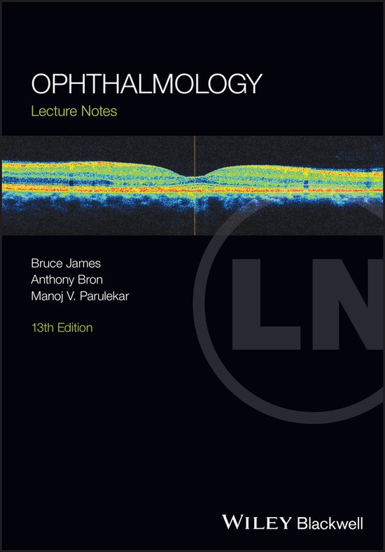 Lecture Notes- Ophthalmology | 9781119905974 | Bruce James | Boeken | bol