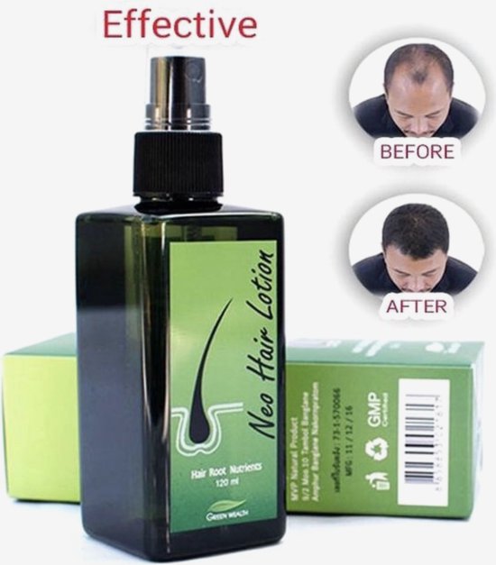 Green Wealth Neo hair lotion - neo hair lotion origineel - original ...
