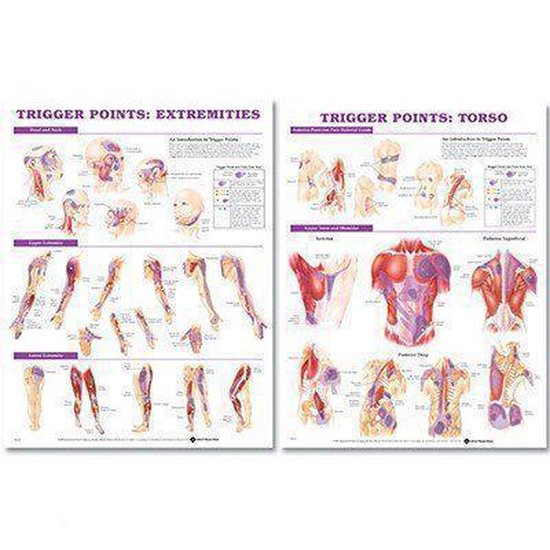 Trigger Point Chart Set, Anatomical Chart Company | 9781587796210 ...