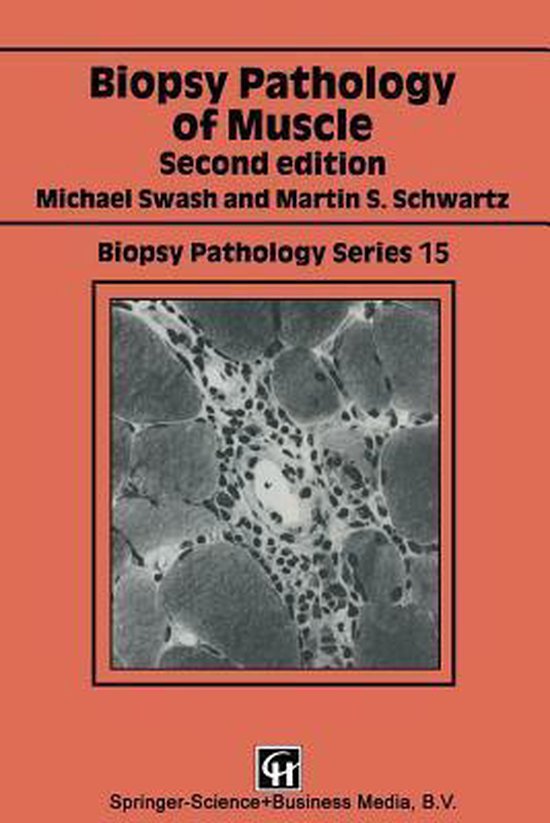 Biopsy Pathology of Muscle | 9780412348808 | Michael Swash | Boeken ...