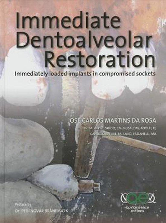 Immediate Dentoalveolar Restoration | 9788578890360 | Jose Carlos Rosa ...