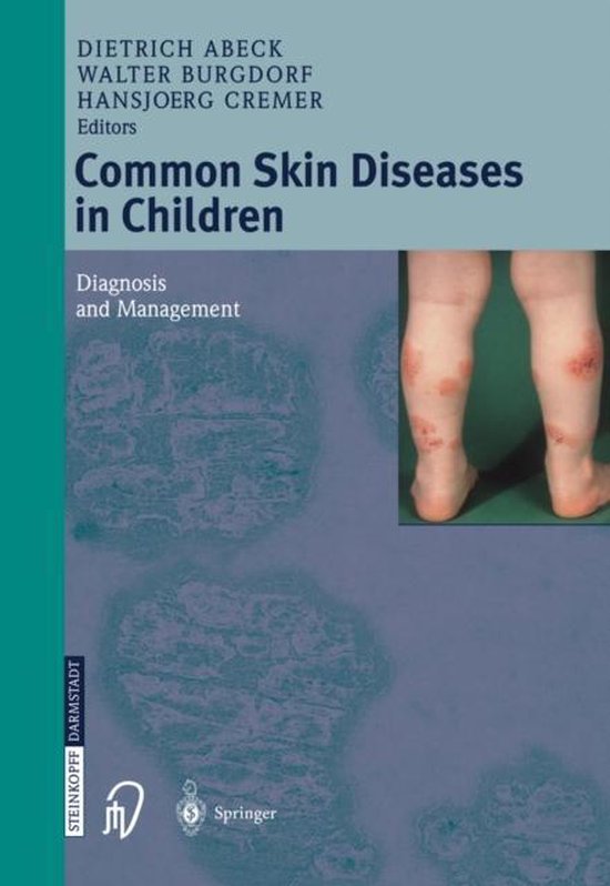 common-skin-diseases-in-children-9783642624179-onbekend-boeken