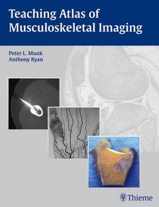 Teaching Atlas Of Musculoskeletal Imaging | 9781588903723 | Peter L ...