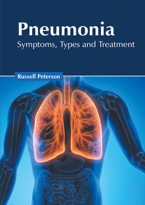 Pneumonia: Symptoms, Types and Treatment | 9781632429278 | Boeken | bol.com