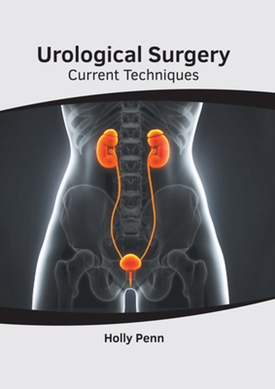 Urological Surgery | 9781632429650 | Boeken | bol.com