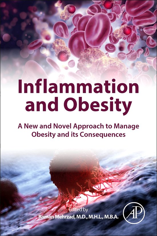 Inflammation and Obesity (ebook) | 9780323909617 | Boeken | bol.com
