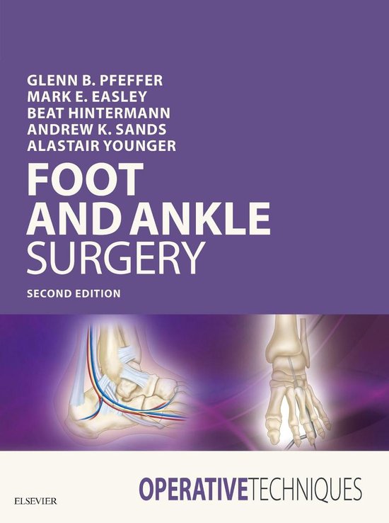Operative Techniques: Foot and Ankle Surgery (ebook), Beat Hintermann ...