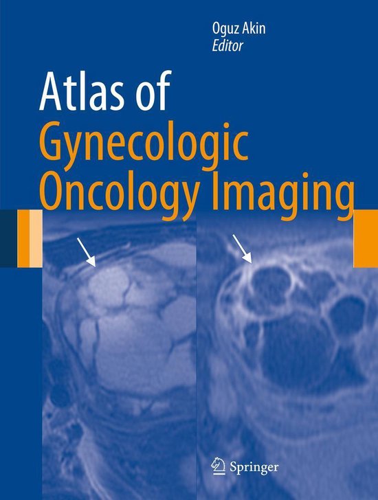 Atlas of Oncology Imaging - Atlas of Gynecologic Oncology Imaging (ebook) |... | bol.com