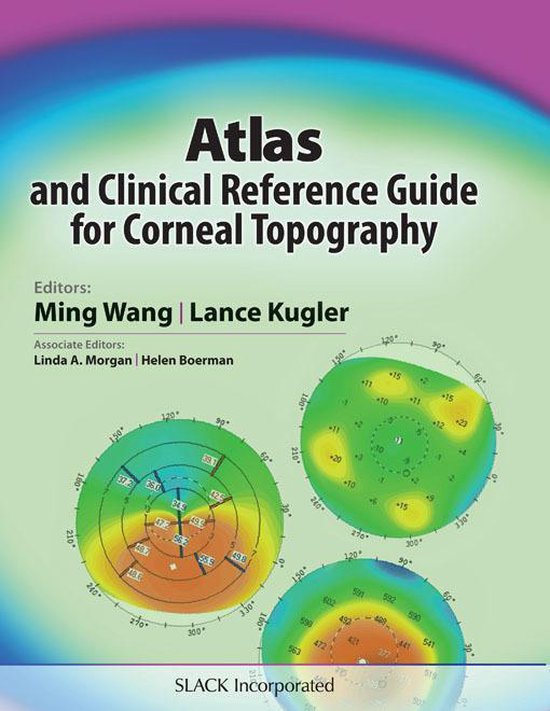 Atlas and Clinical Reference Guide for Corneal Topography (ebook), Ming ...