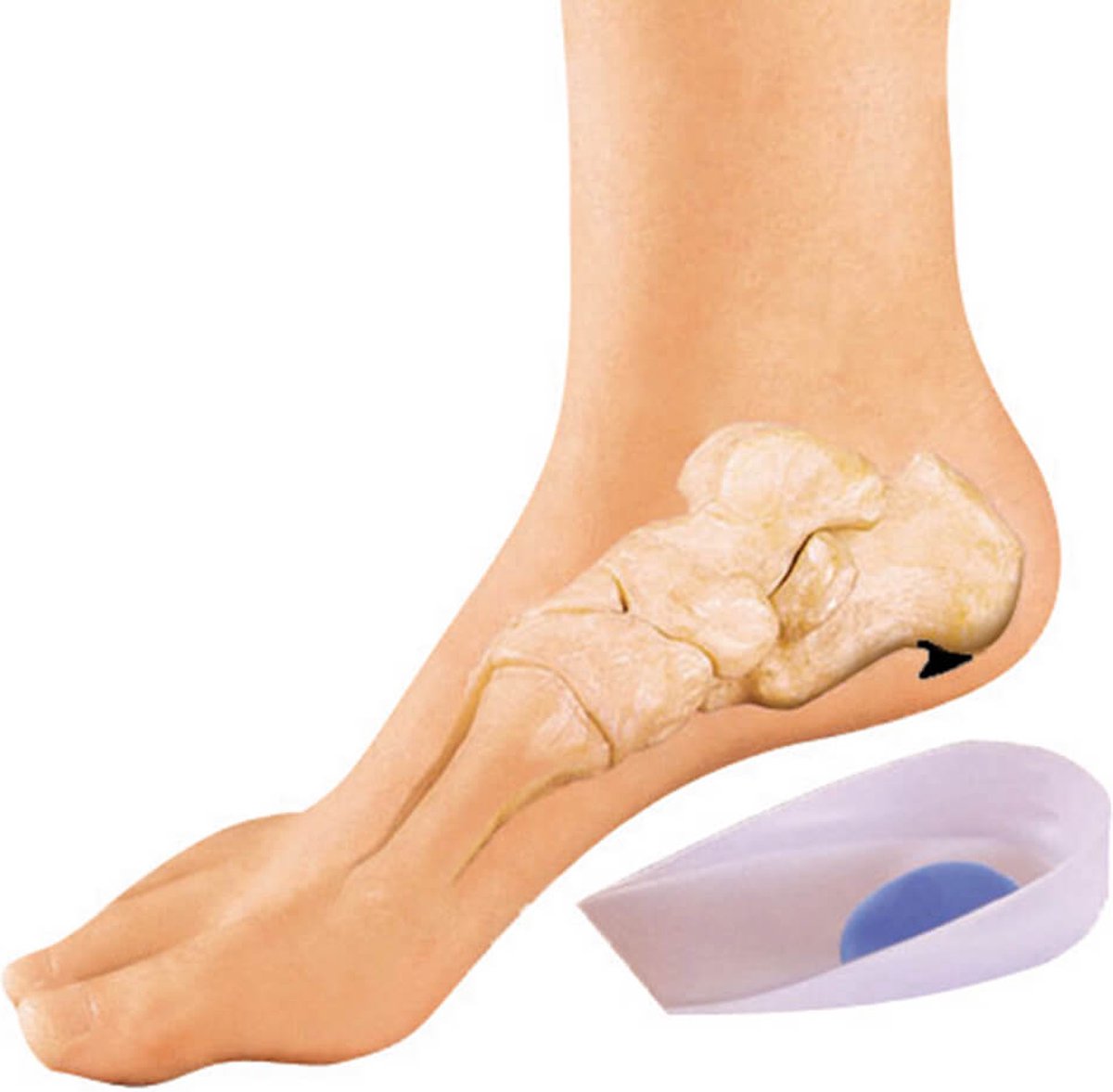 Hielspoor zooltjes | bol