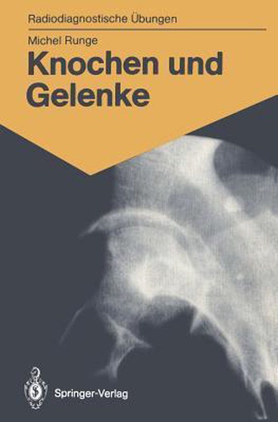 Knochen und Gelenke | 9783540165439 | Michel Runge | Boeken | bol.com