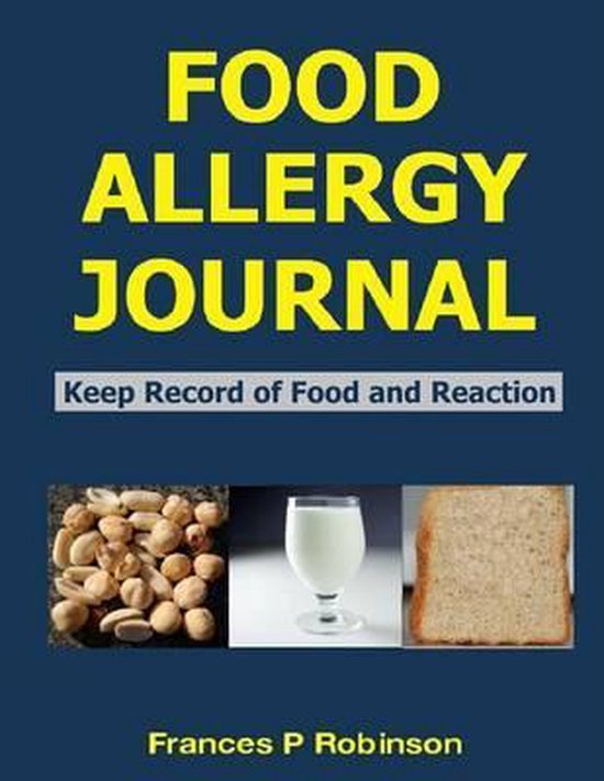 Food Allergy Journal, Frances P Robinson | 9781508724094 | Boeken | bol.com