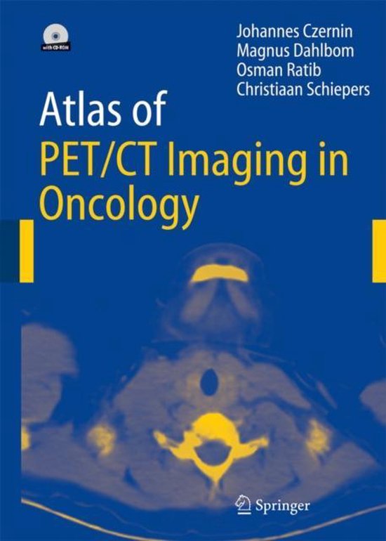 Atlas of Pet/Ct Imaging in Oncology | 9783642621413 | Johannes Czernin | Boeken | bol