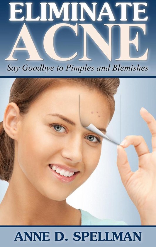 Eliminate Acne (ebook), Anne D. Spellman | 9781519918901 | Boeken | bol.com