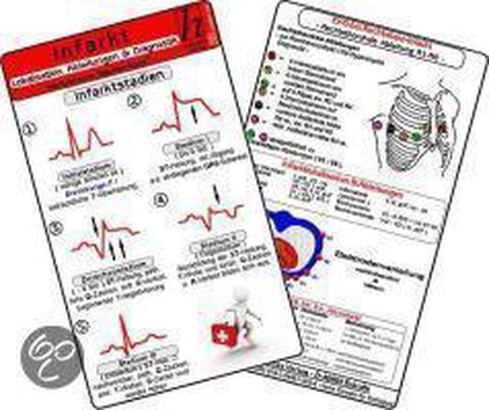 Infarkt - Lokalisation, Ableitungen & Diagnostik | 9783869570006 ...