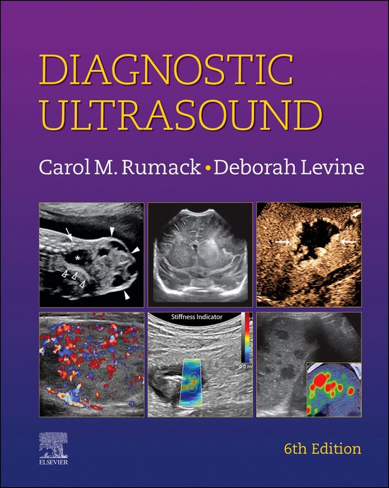 Diagnostic Ultrasound E-Book (ebook) | 9780323877978 | Boeken | bol
