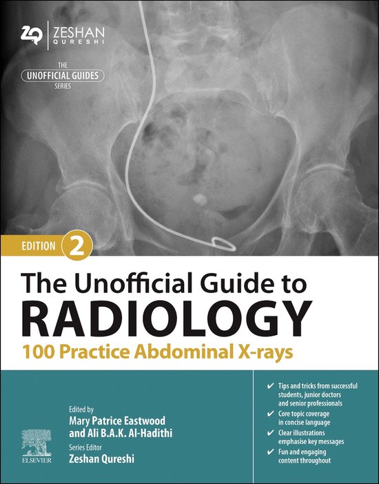 Unofficial Guides - The Unofficial Guide to Radiology: 100 Practice ...