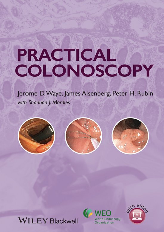 Practical Colonoscopy | 9780470670583 | Jerome D. Waye | Boeken | bol