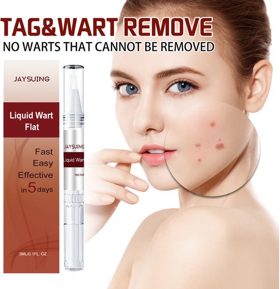 4 stuks wrattencrèmepen, huidlabels, gram wratten, vervagen ...