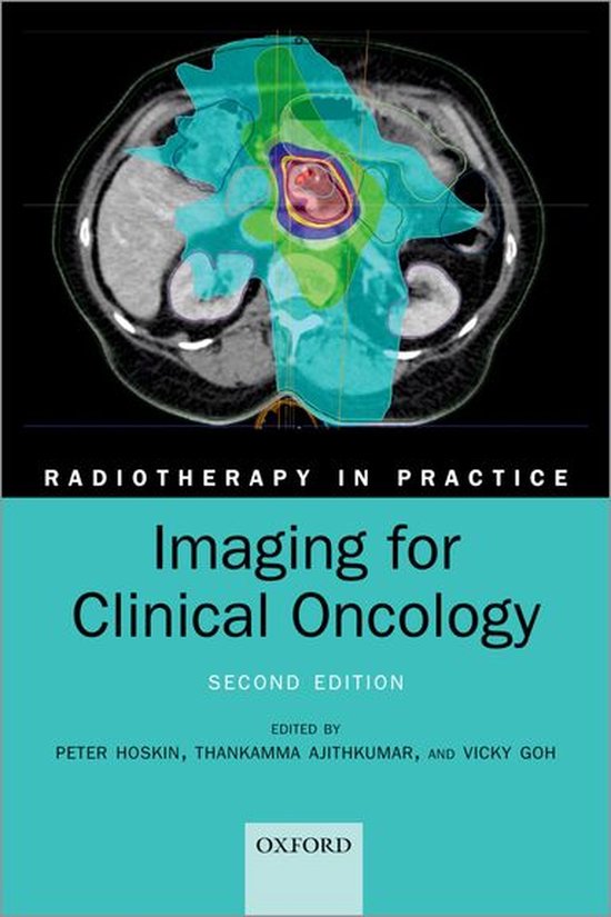 Radiotherapy in Practice - Imaging for Clinical Oncology (ebook) | 9780192637253 | Boeken | bol.com