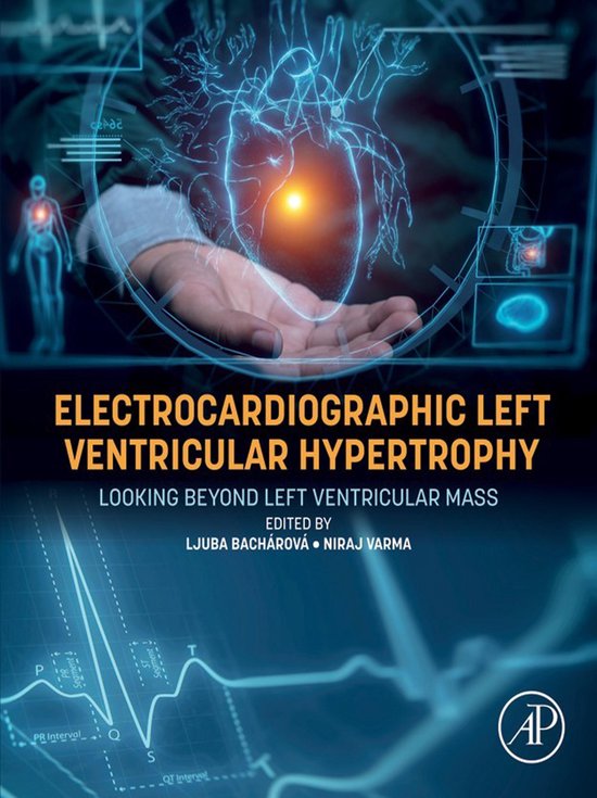 Electrocardiographic Left Ventricular Hypertrophy Ebook 6844