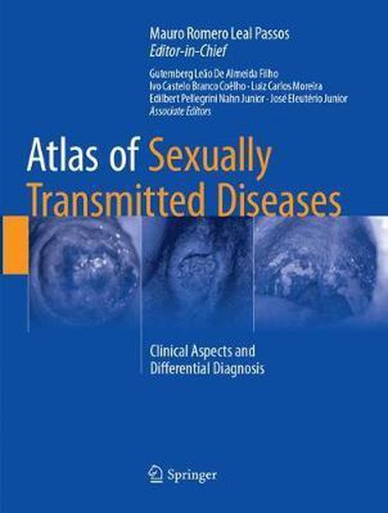 Atlas Of Sexually Transmitted Diseases 9783319861708 Boeken Bol