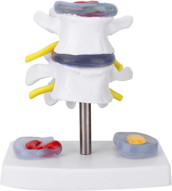 Lumbar Vertebral Model with Detachable Base - Excellent Way to ...