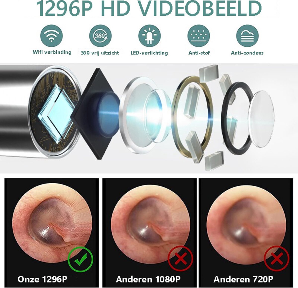 Bolture Oorsmeer Verwijderaar - Otoscoop voor Thuis - Oorreiniger met ...