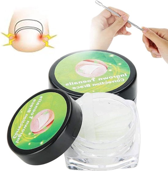 Nagelcorrectie Stickers - Teennagelverzorging Pedicure - Ingegroeide ...