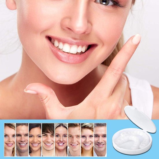 Tijdelijke beugels - Bovenste en onderste nep smile-beugels ...