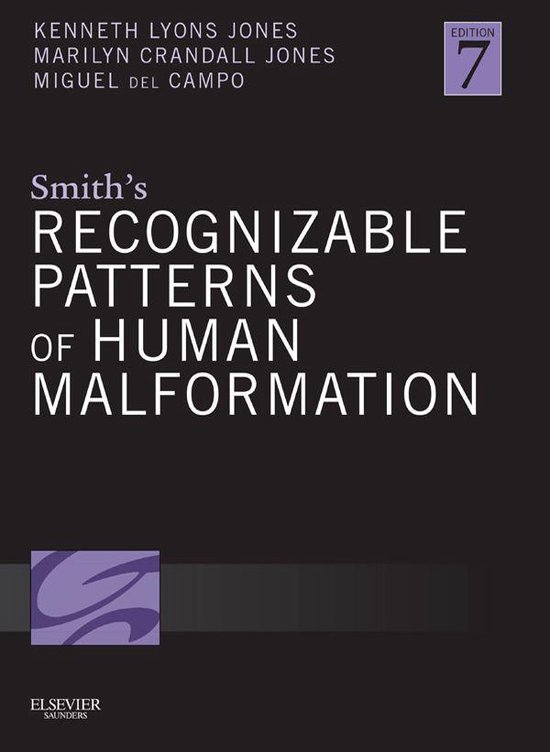 Smith's Recognizable Patterns of Human Malformation (ebook), Kenneth ...
