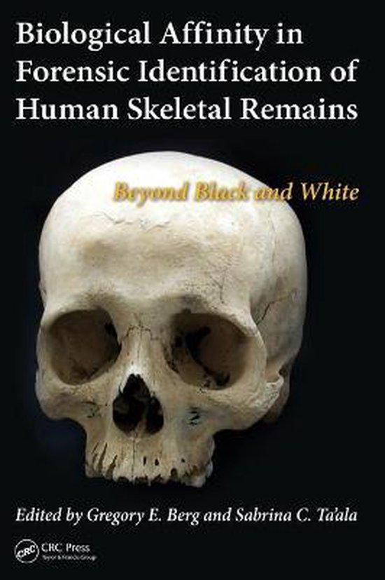 Biological Affinity in Forensic Identification of Human Skeletal ...