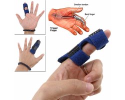 Gebroken vinger | Wat te doen bij een vingerfractuur?