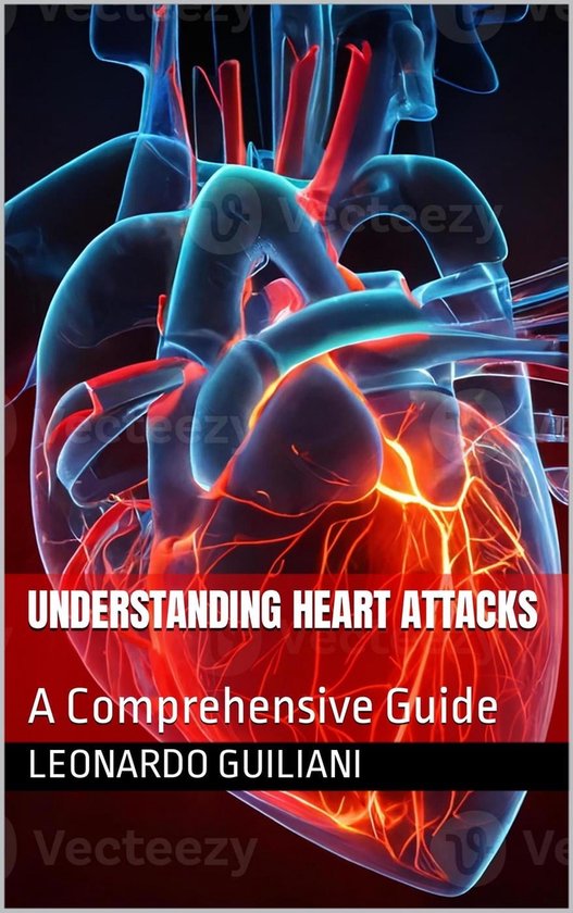 Understanding Heart Attacks A Comprehensive Guide (ebook), Leonardo ...