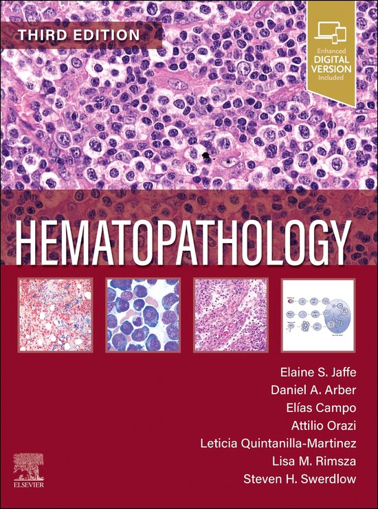 Hematopathology | 9780323831659 | Elaine Sarkin Jaffe | Boeken | bol