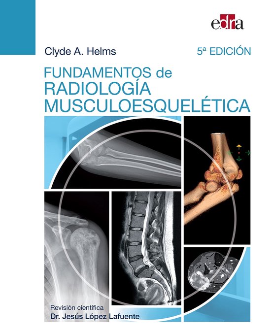 Fundamentos de radiología musculoesquelética (ebook), Clyde A. Helms ...