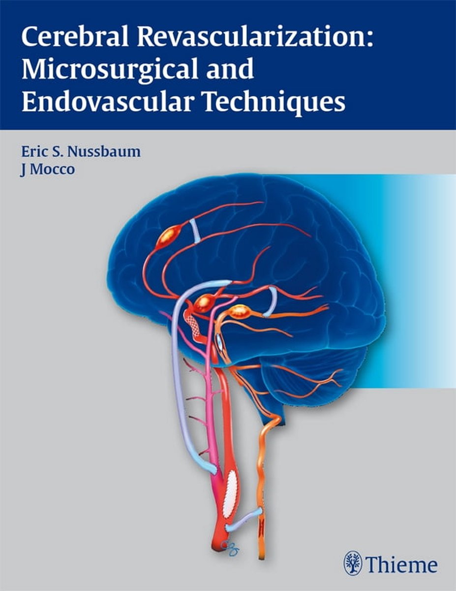 Cerebral Revascularization: Microsurgical and Endovascular Techniques ...
