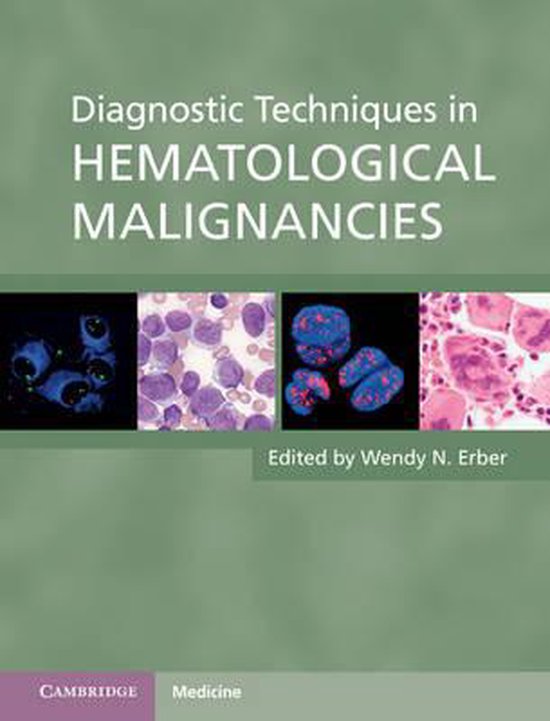 Diagnostic Techniques in Hematological Malignancies | 9780521111218 ...