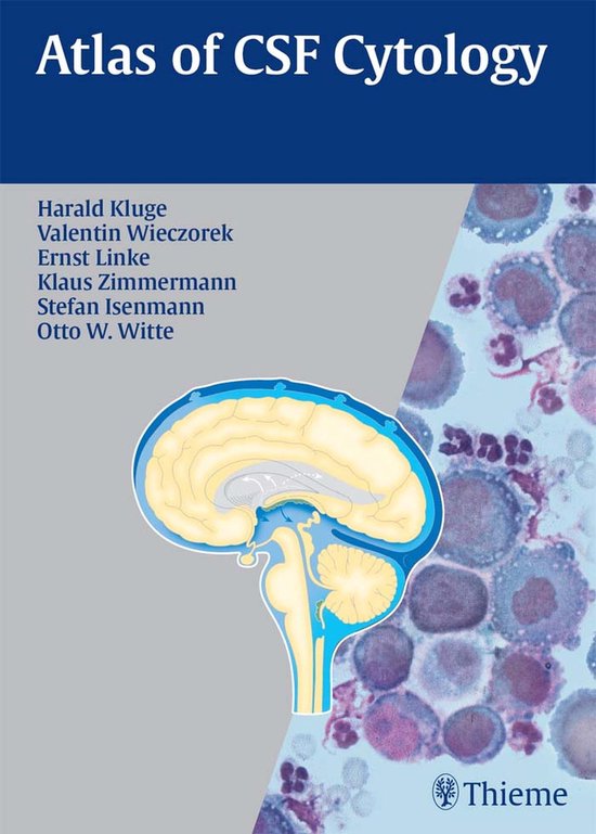 Atlas of CSF Cytology (ebook), Harald Kluge | 9783132578449 | Boeken | bol