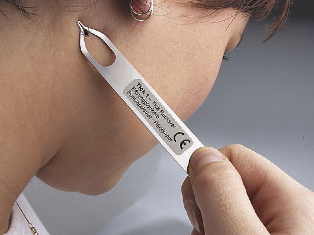 Tick 1 - Tekenverwijderaar / Tekentang Tick 1 - van RVS - tijdelijk met ...