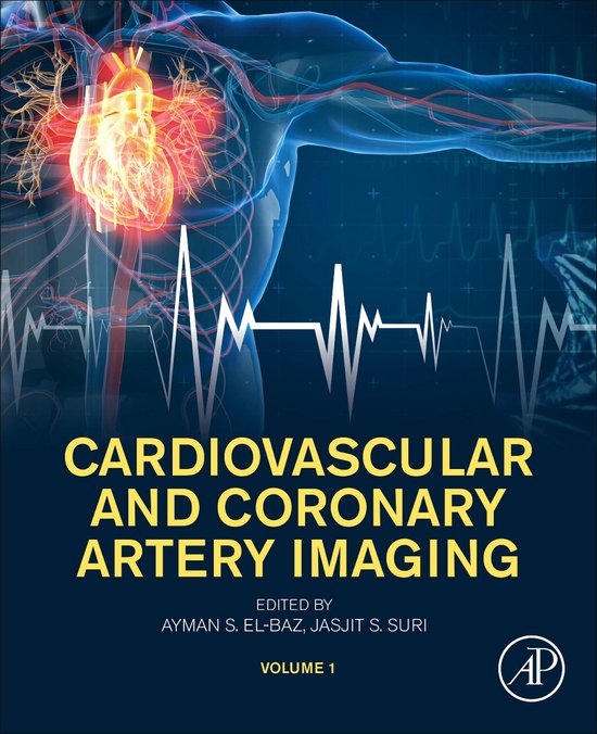 Cardiovascular and Coronary Artery Imaging (ebook) | 9780128227077 ...
