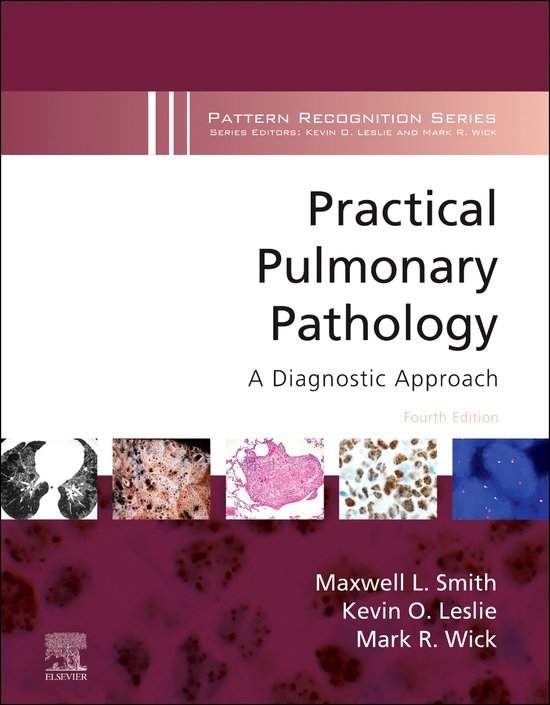 Pattern Recognition - Practical Pulmonary Pathology: A Diagnostic ...