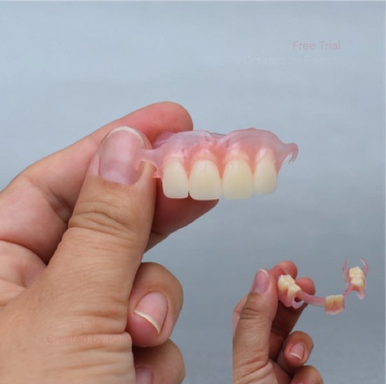 Flexibele prothese bovenkaak - op maat gemaakt - Boven - kunstgebit ...