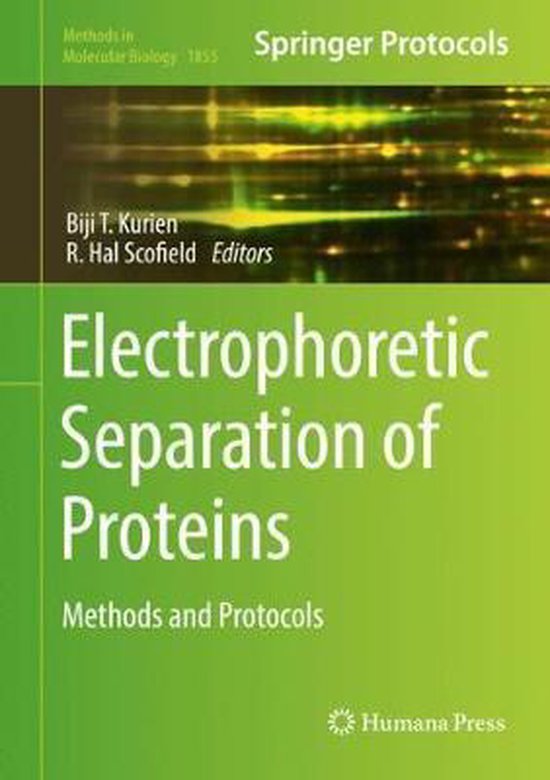 Methods in Molecular Biology- Electrophoretic Separation of Proteins | 9781493987924 |... | bol.com