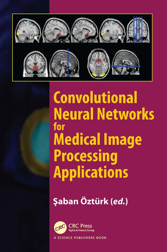 Convolutional Neural Networks for Medical Image Processing Applications |... | bol