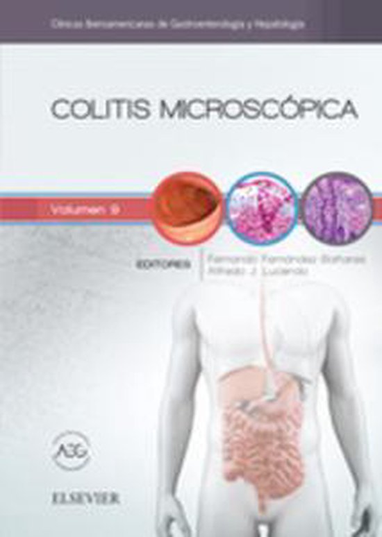 Colitis microscópica (ebook), Antoni Castells Garangou | 9788491131465 ...