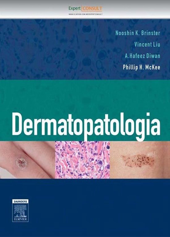 Dermatopatologia (ebook), Nooshin K. Brinster | 9788535259742 | Boeken | bol.com