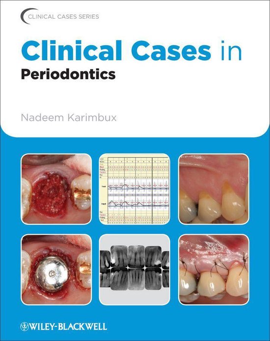Clinical Cases (Dentistry) 42 - Clinical Cases in Periodontics (ebook ...